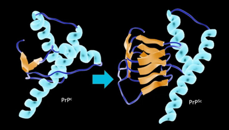 Types of Prion Disease - CJD Foundation